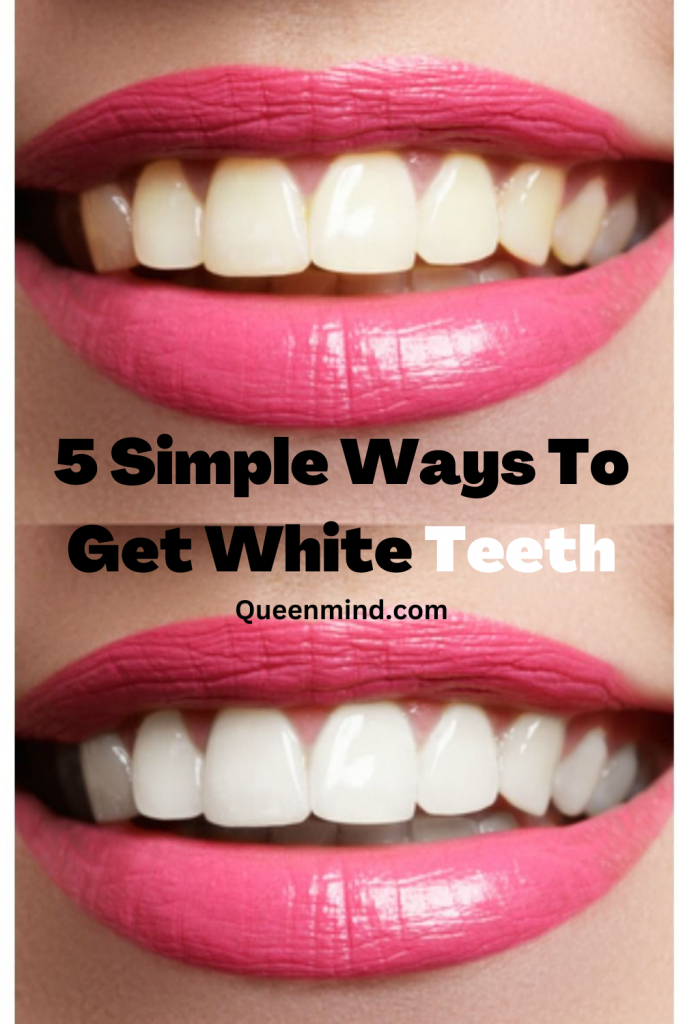 How To Get Whiter Teeth At Home Naturally Queenmind