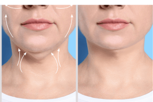 10 Proven Double Chin Exercises That Actually Work - QueenMind